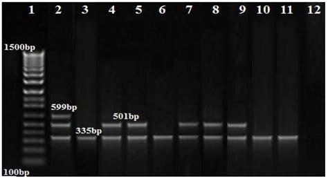 Biology Free Full Text Characterization Of Acinetobacter Baumannii