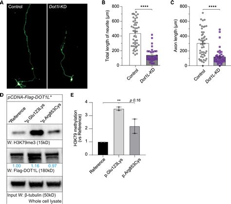 Rare De Novo Gain Of Function Missense Variants In Dot1l Are Associated