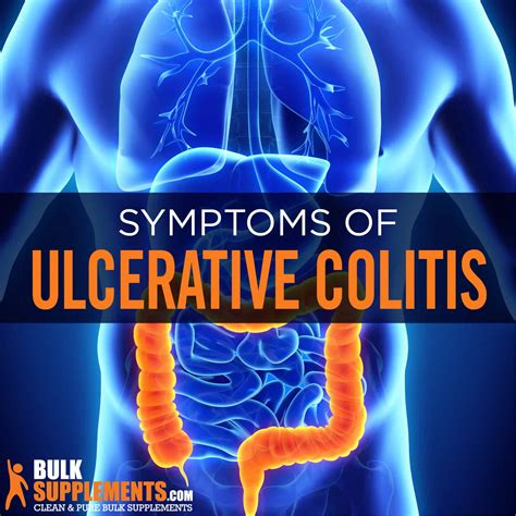 Ulcerative Colitis Symptoms Causes And Treatment