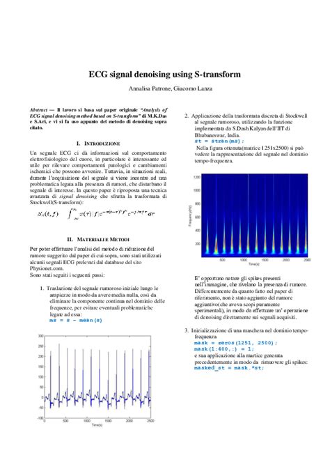 pdf s transform appication in denoising signals jack lenz