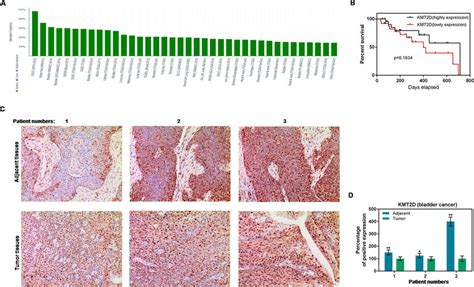 Mutation Frequency And Immunohistochemical Staining Of Kmt2d In Bladder