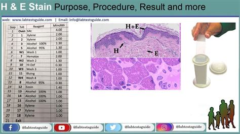 Hande Stain Lab Tests Guide