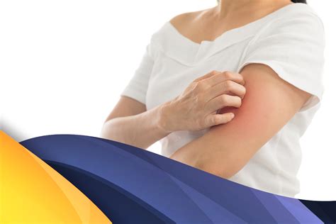 Understanding Psoriasis Its Causes And How To Manage It Klse Screener