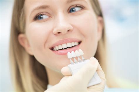 Everything You Need To Know About Dental Veneers