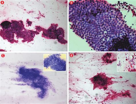 A Photomicrography Of The Epithelial Cells Arranged In A Honeycomb