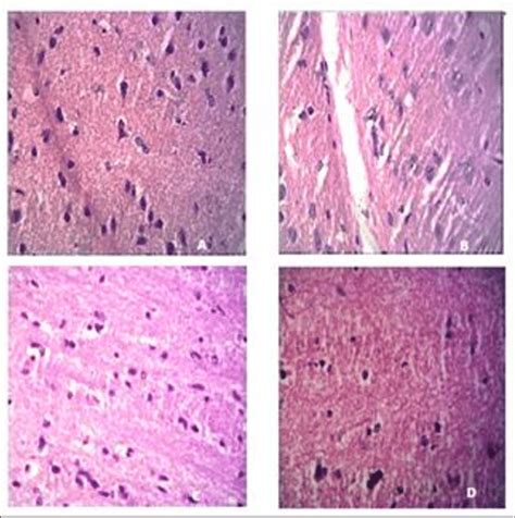 Histopathology Of Mice Brain After Treatment Figure 4 A Histologically