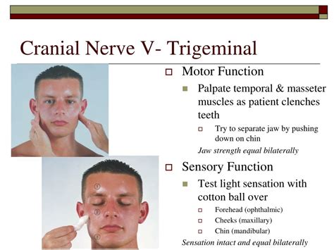 The Trigeminal Nerve Cn V Nerve Cranial Nerves Anatom