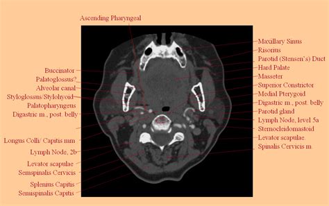 Ascending Pharyngeal Artery