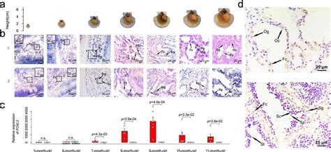 Gonad Histology And Foxl2 Expression During Early Sex Download