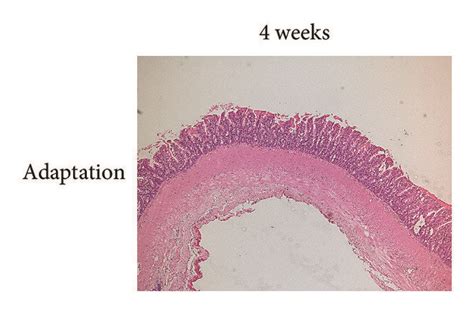 Histological Analysis Of Regenerative Constructs Under Various