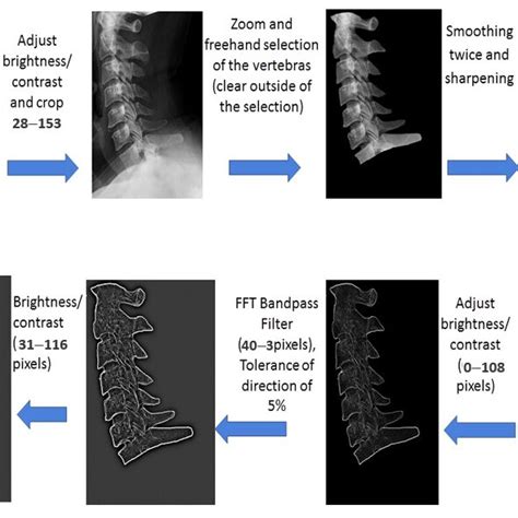 features extraction using the glcm method applied to the neck s x ray
