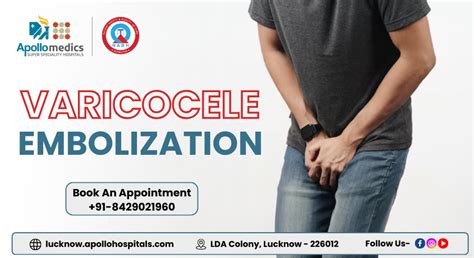 Varicocele Embolization Apollomedics Hospital