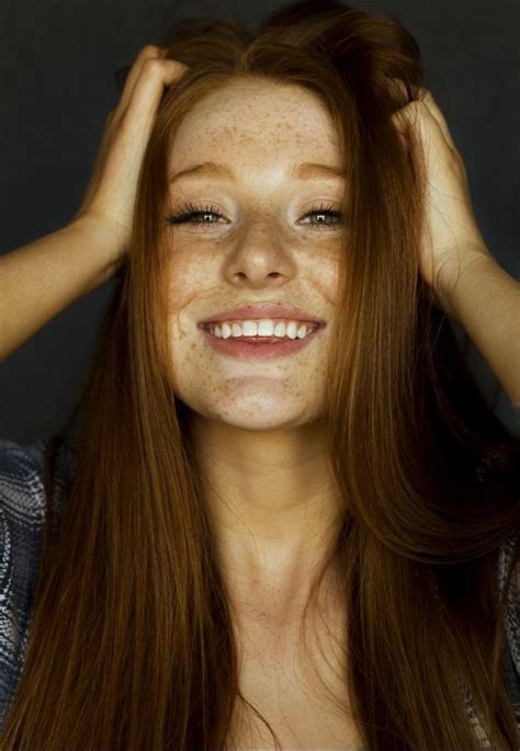 Pin By Island Master On Beautiful Freckles Gingers Beautiful Freckles