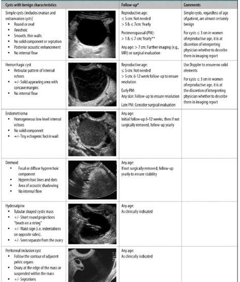 Ovarian Cyst F U Guideline – Radiology World
