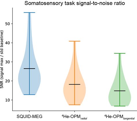 Average Signal To Noise Ratio Per Modality Sensor Type And Axis Black