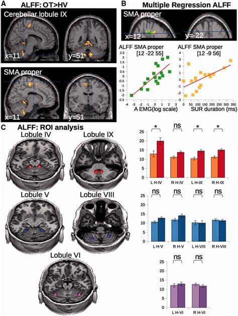 Group Differences In Alff And Correlation Of Alff With Clinical Scores