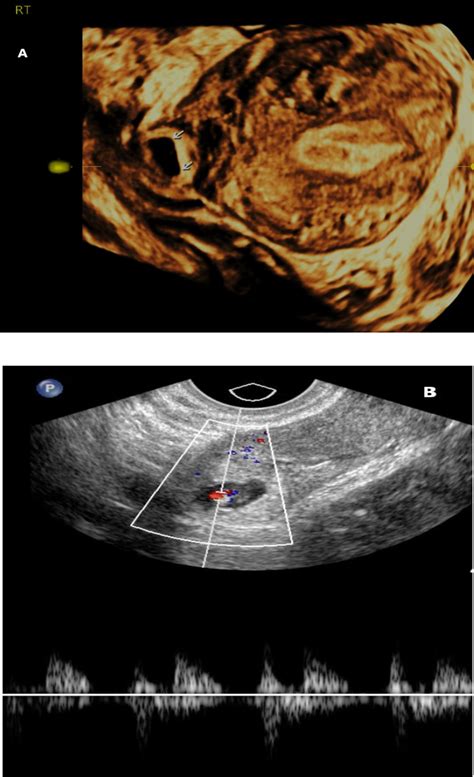 Figure 1 From Comparison Of The Clinical Process Outcomes Of Non