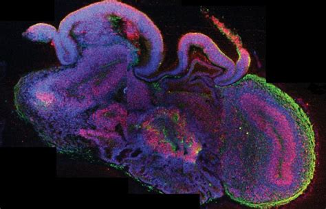 researchers create the first lab grown human ‘mini brains