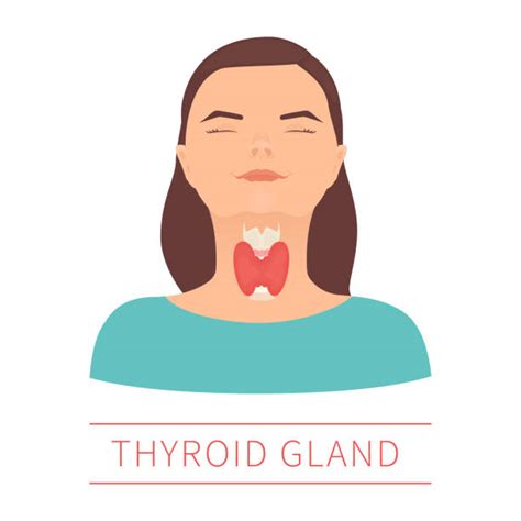 Hyperthyroidism Illustrations Royalty Free Vector Graphics And Clip Art