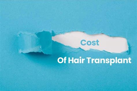 7 Hair Transplant Side Effects And Risks You Should Know