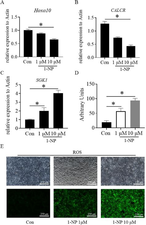 Effects Of 1 Np Exposure On Human Uterine Epithelium Receptive Markers