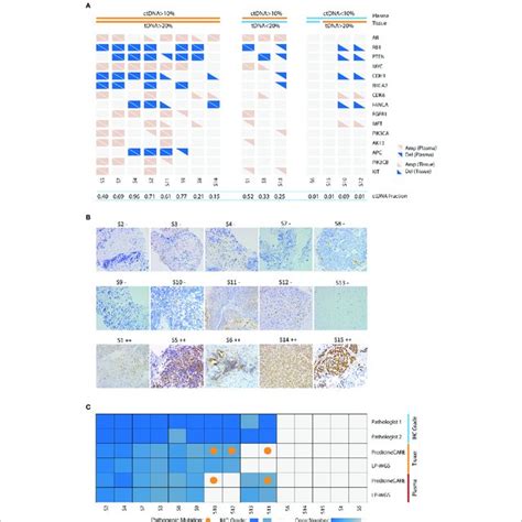 Genomic Alterations Of Tp53 Rb1 And Pten Detected In 52 Mcrpc