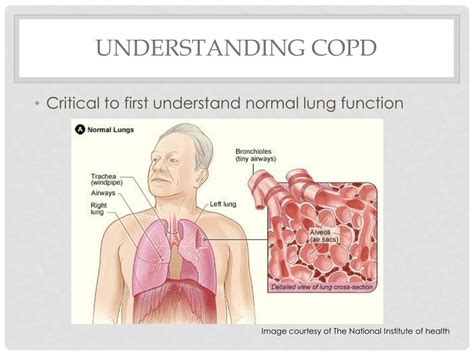 Ppt Copd Powerpoint Presentation Free Download Id 610776