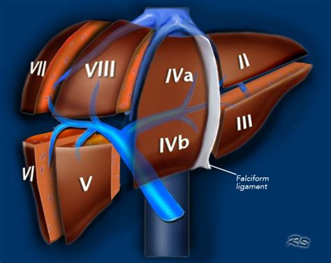 The Radiology Assistant Liver Segmental Anatomy