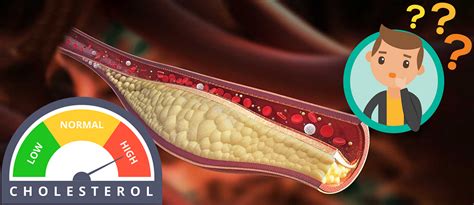Myths About Cholesterol — Demystified By Jishnudeep Kar Medium