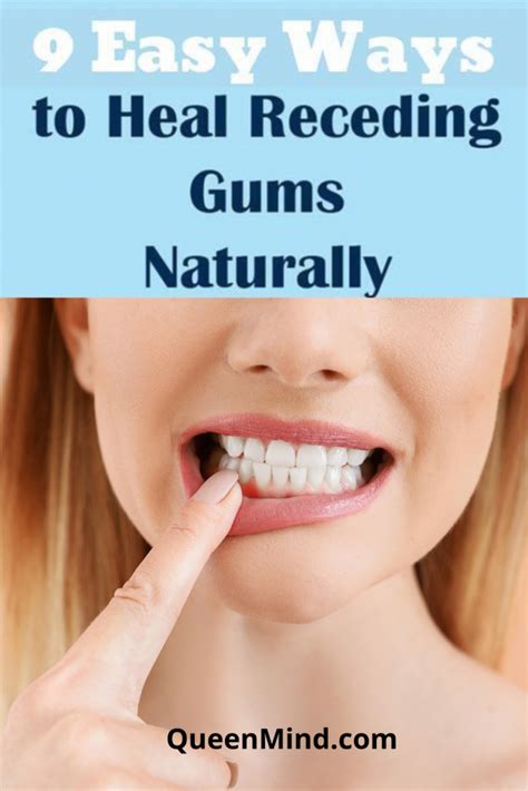 9 Easy Ways To Heal Receding Gums Naturally – Artofit