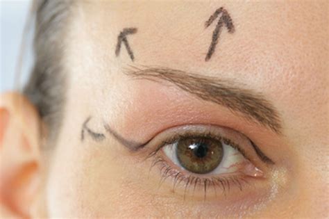 Lifting Visage Tunisie Chirurgie Esthtique Du Visage