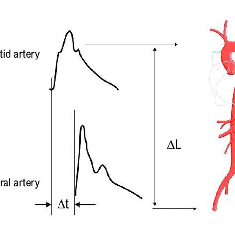 Measurement Of Carotid Femoral Pulse Wave Velocity With The