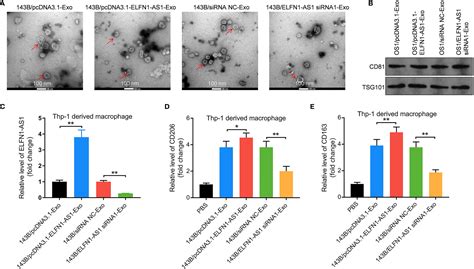 Frontiers Osteosarcoma Cell Derived Exosomal Elfn1 As1 Mediates