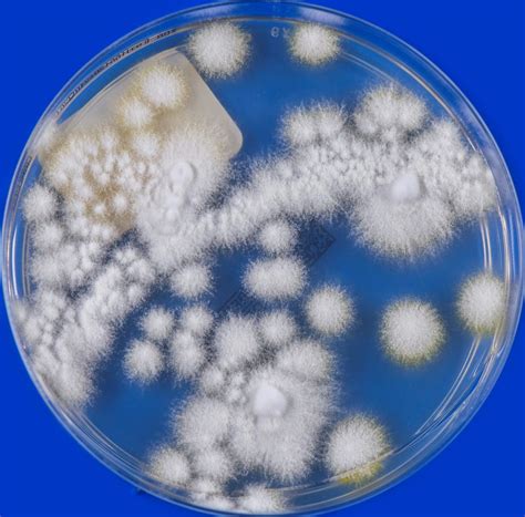 Trichophyton Mentagrophytes Mykologie Experten Labor Mölbis Leipzig