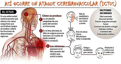 Cómo Actuar Ante Un Ictus Soy Seguridad Privada