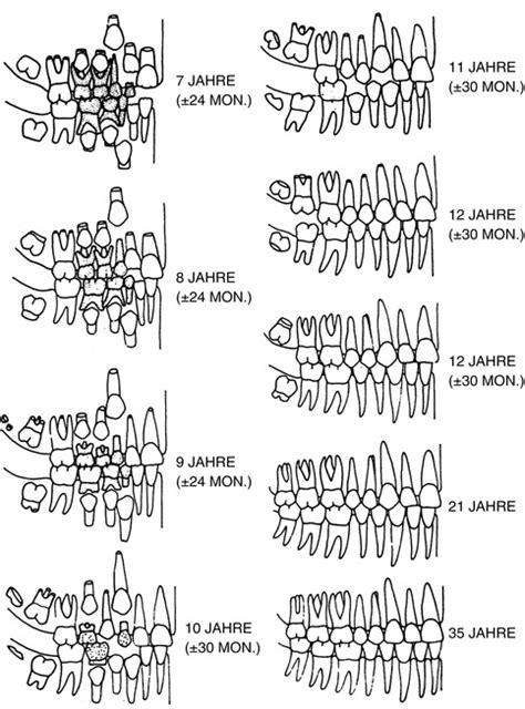Figure From Age Estimation By Dental Developmental Stages 55 Off