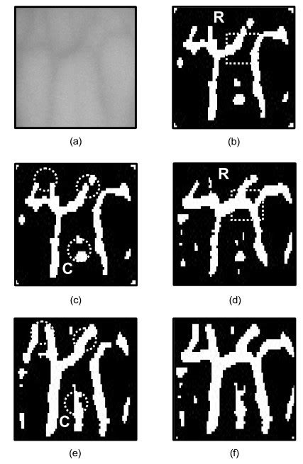 how to make the right kernel and use sepfilter2d to solve vessels