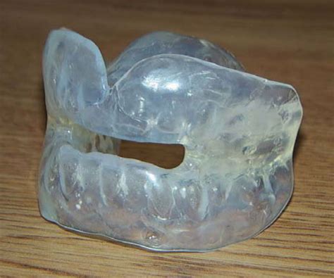 Treatment Of Sleep Apnoea Using A Mandibular Advancement Splint An