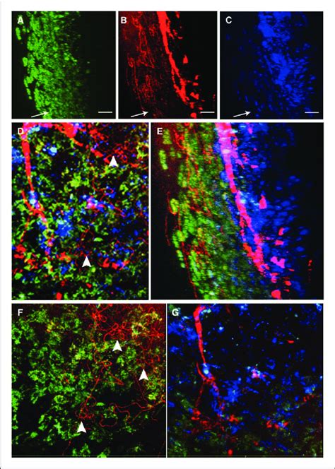 Two Photon Microscopy Of Fibroblast Distribution In S C Mls Tumors