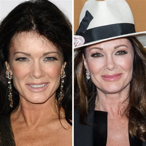 Housewives With Plastic Surgery Slice