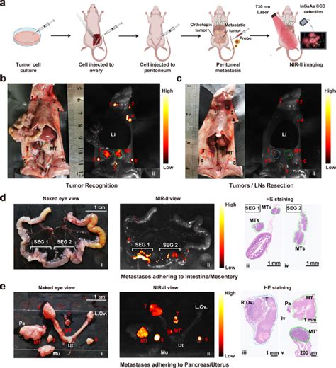 Nir Ii Imaging Of Orthotopic And Metastatic Tumors In An Advanced