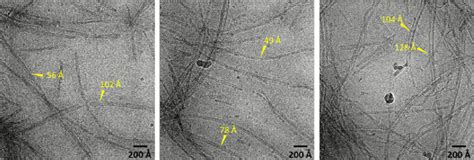 Representative Cryo Em Micrographs Of G51d α Synuclein 60 μm