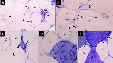 A Photomicrograph Of Inguinal Adipose Tissue Semi Sections Showing