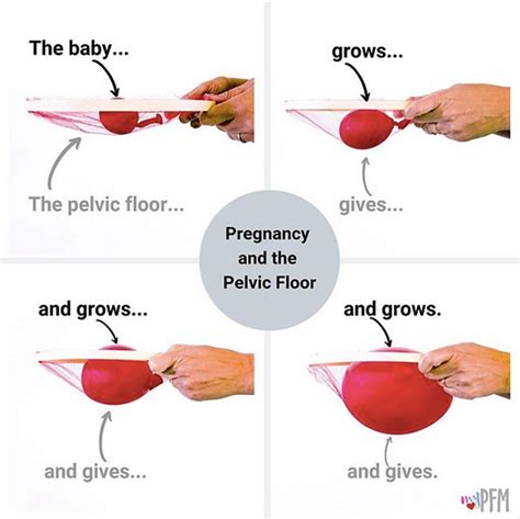 Pelvic Floor Exercises During Pregnancy