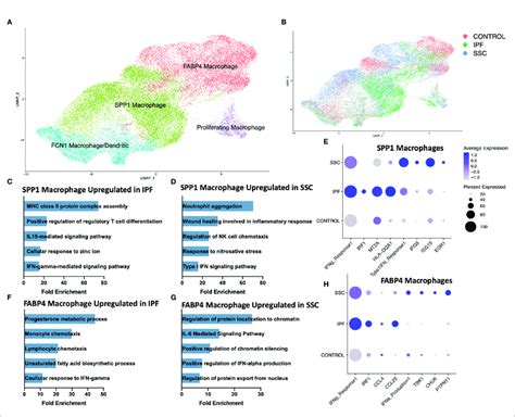 Scrna Seq Analysis Of Ipf Ssc Ild And Control Myeloid Populations