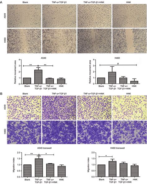 Hnk Inhibits The Migration Of A549 And H460 Cells Induced By