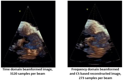Sub Nyquist Ultrasound Imaging Yonina Eldar
