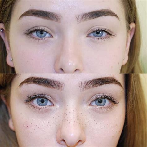 People Are Tattooing Freckles On Their Face And This Is What It Looks Like