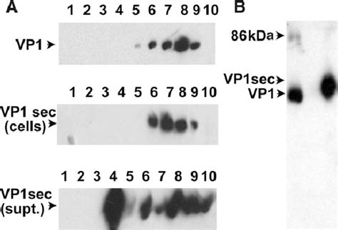 Fractionation Of Vp1wt And Vp1sec Vlps On Cscl Gradients A High