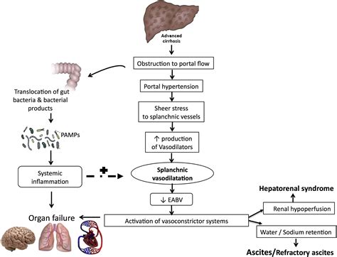 Ascites And Hepatorenal Syndrome Clinics In Liver Disease
